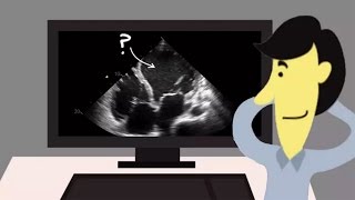 Echocardiographer Overview | What is an echocardiographer? - Zippia