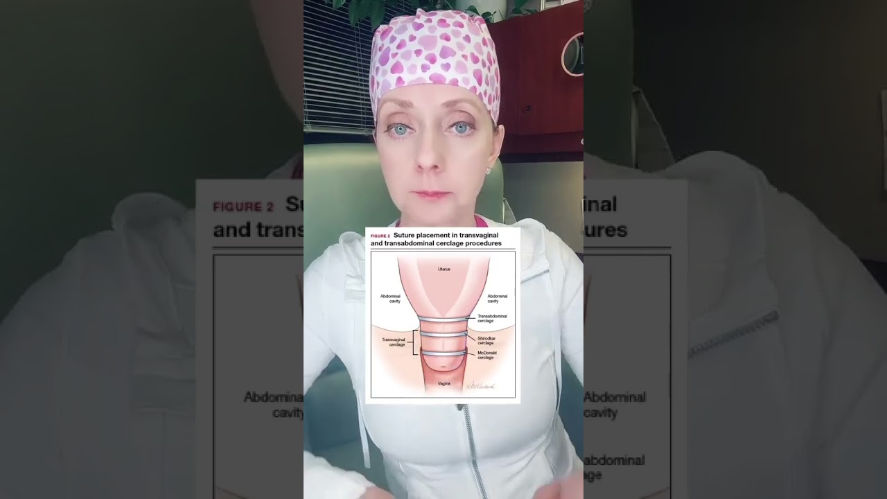 Transabdominal cerclage for cervical insufficiency