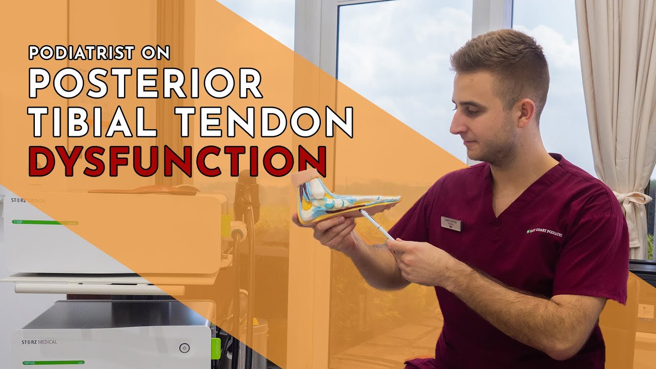 Posterior Tibial Tendon Dysfunction (PTTD) - Senior Podiatrist Lewis Nurney, East Coast Podiatry