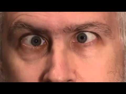 Sixth (6th) Cranial Nerve Palsy