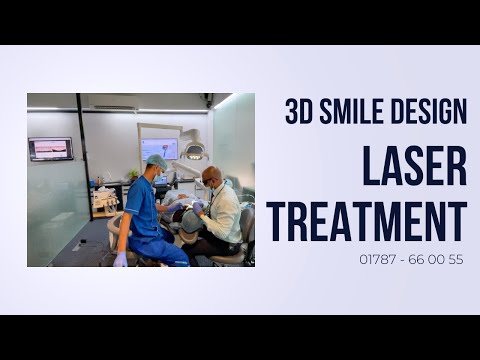 3D Smile Design | Laser Treatment