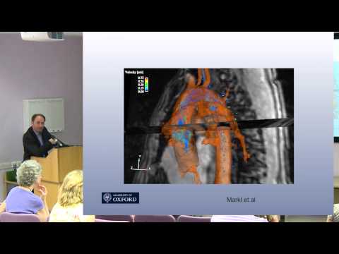 New approaches to Marfan syndrome - Alex Pitcher