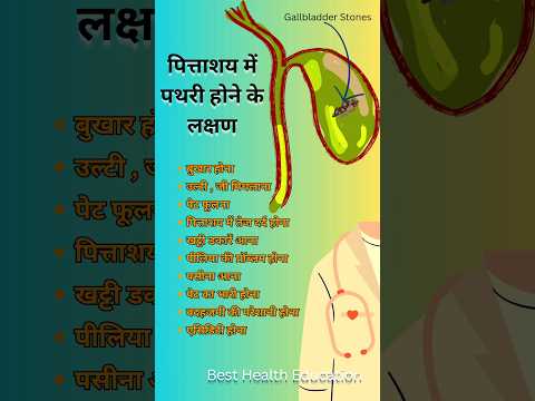 पित्ताशय में पथरी होने के लक्षण। #shorts