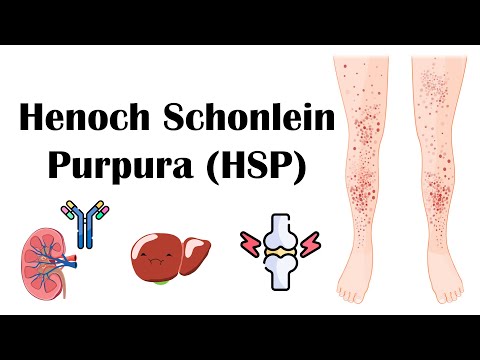 Henoch Schoenlein Purpura (HSP) - Causes, Pathophysiology, Diagnosis, And Treatment