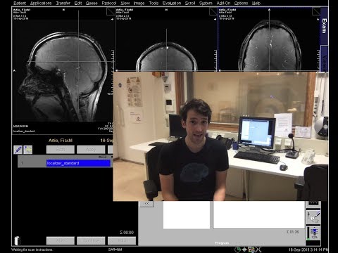 Tutorial on scanning high-resolution EPI on SIEMENS scanners – layer ...