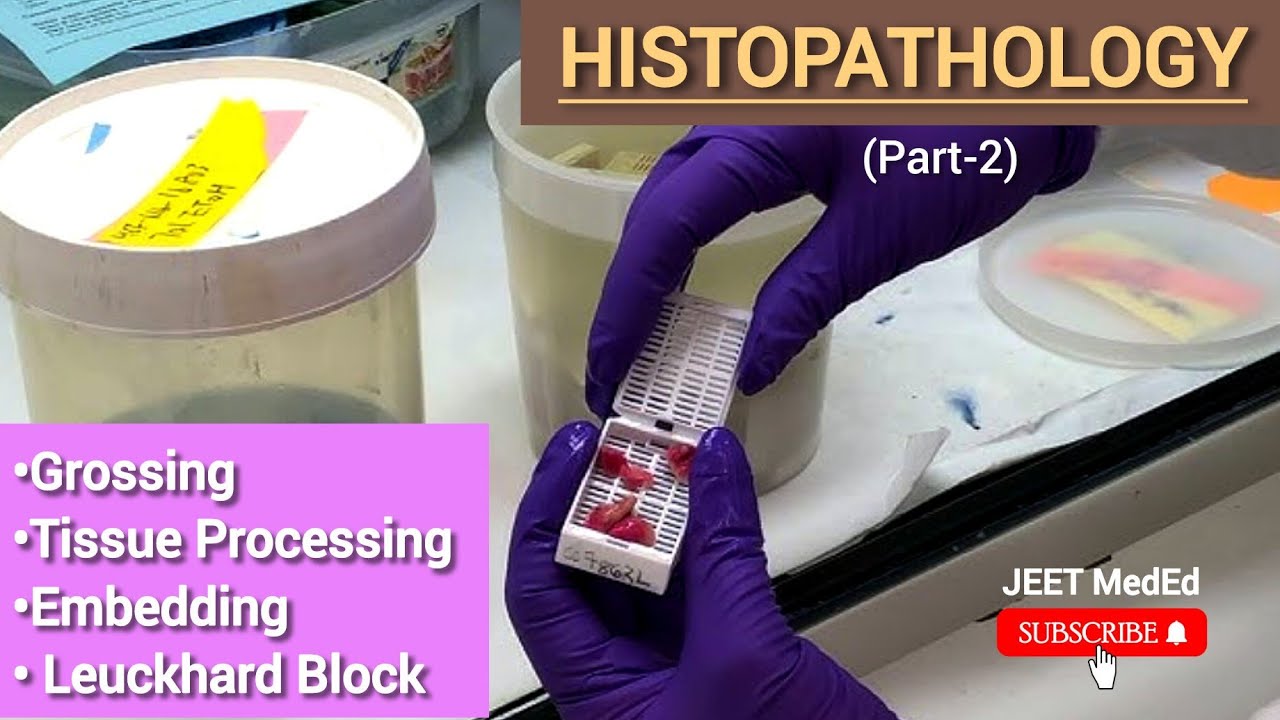 Histopathology (Part-2) Grossing &Tissue processing of biopsy sample