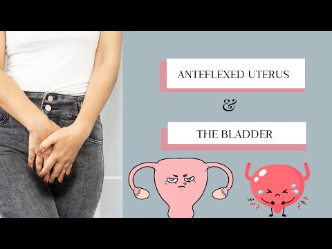 Anteflexed Uterus