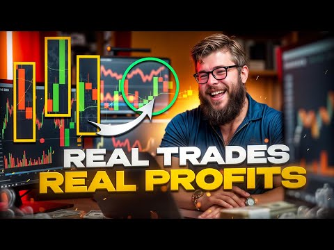 🔴 LIVE TRADING | Pocket Option Strategy with ZigZag + SuperTrend
