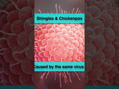 Shingles or Zona in 1 minute
