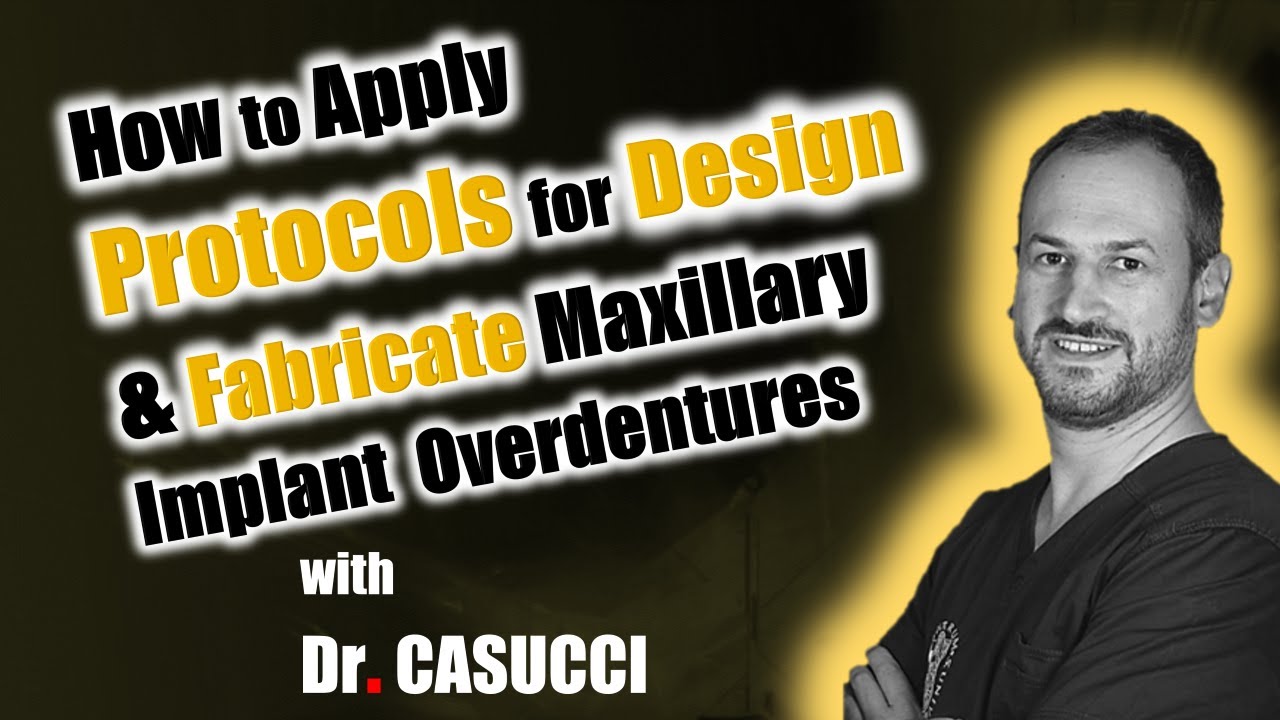 How to apply Protocols for Design and Fabricate Maxillary Implant Overdentures