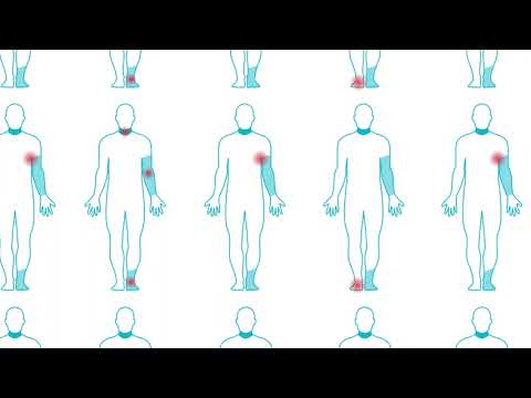 Why Choose InterDry Skin Fold Management?
