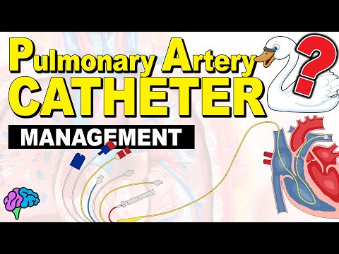 PA Catheter Management