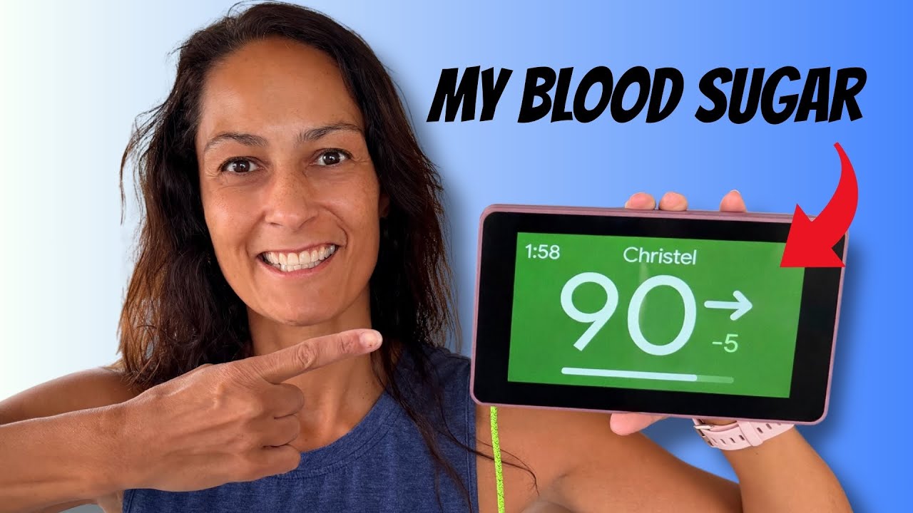 External CGM Display for Dexcom & Libre - Sugardash Review