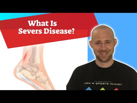 What is Severs Disease