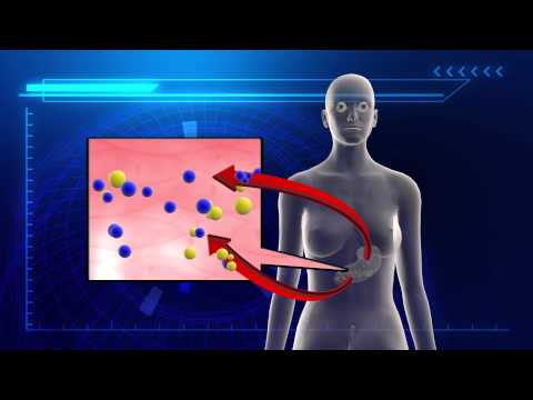 Cloned human cells could offer a cure for diabetes