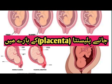 placenta types in urdu || placenta posterior || placenta anterior | Placenta previa |Retain placenta