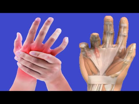 Stiff Fingers: Causes and Treatments