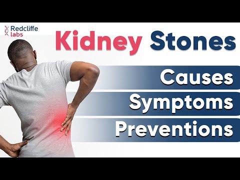 Kidney Stone Pain Location