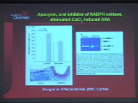 The Role of Oxidative Stress and AAA Pathobiology
