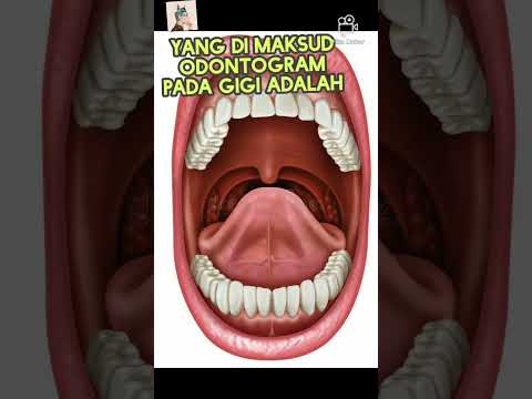 Udah pada tau belum odontogram itu apa.. ODONTOGRAM pada gigi adalah ??? #wawasancerdas