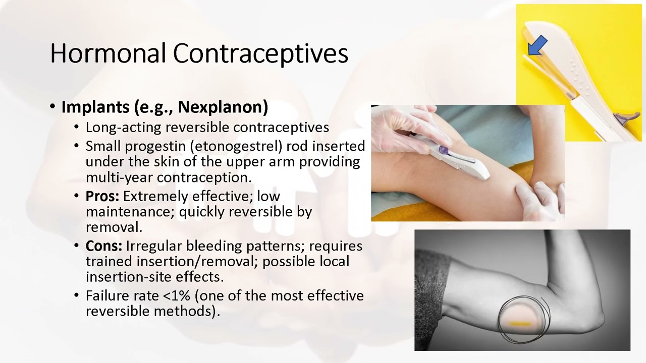 Methods of Family Planning