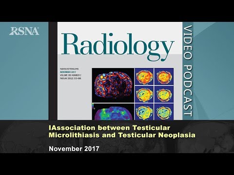 Association between Testicular Microlithiasis and Testicular Neoplasia (November 2017 Radiology)