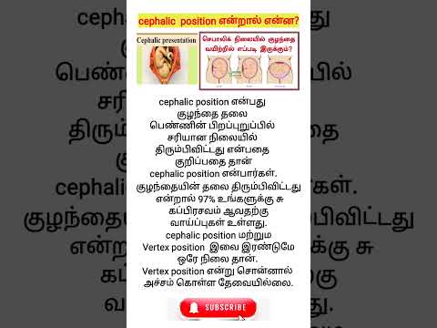 cephalic position of a baby | baby position |cephalicposition | headdownposition |