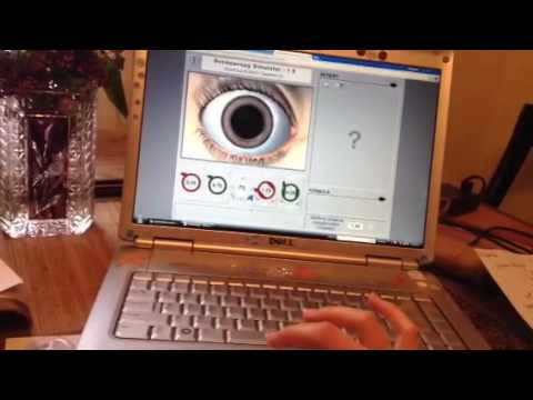 How To Optometry: Retinoscopy, Working distance, Optical Crosses combined