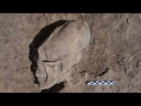 Russian Scientists Unearthed This 2,000 Year Old Skeleton And Were Stunned By Its Alien Like Skull