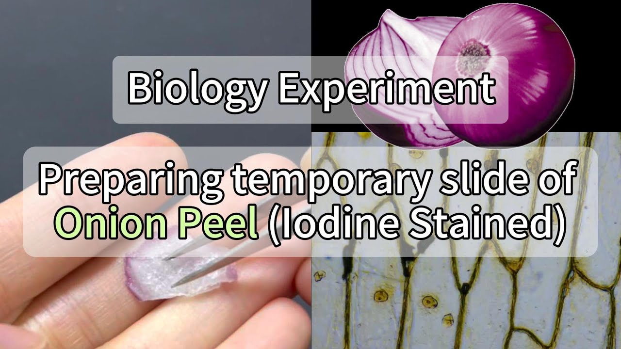 Preparing temporary slide/mount of Onion Peel (Iodine Stained) Under the Digital Microscope
