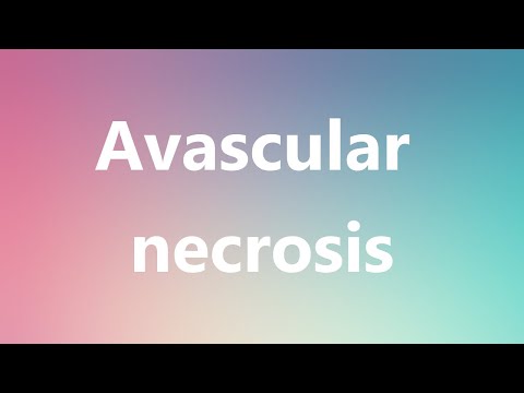 Avascular necrosis - Medical Definition