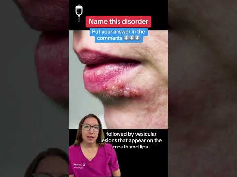 Name this disorder #40: Medical Surgical SHORT | @LevelUpRN