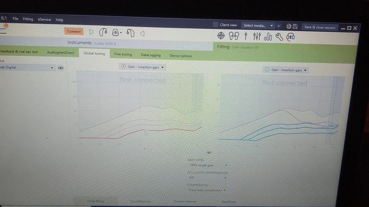 Videos or PDF of complete fitting procedure for Phonak? - Hearing Aid ...
