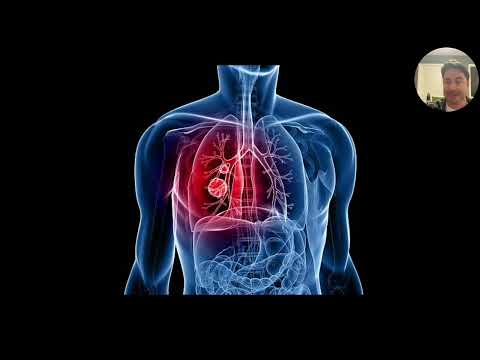 PNA pt 5