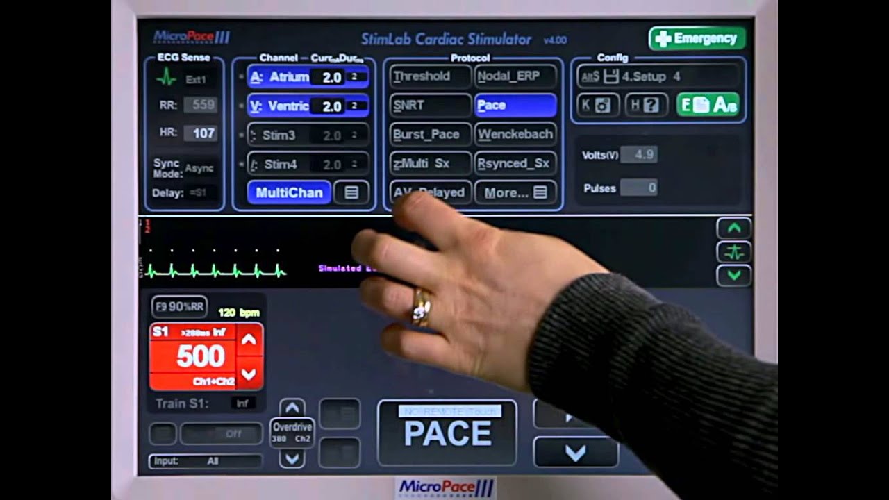 5A - Advanced Pacing - Multi-Channel Pacing