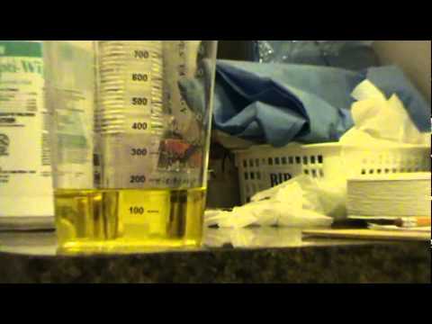 Measuring Urine Output | Assisting with urinary elimination