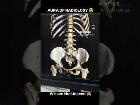 Aura of RADIOLOGY ❤ #hospital #xray #radiography #rajabfamily