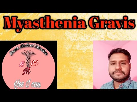 Myasthenia Gravis | Etiology, Pathophysiology, Clinical Features, Diagnosis, Treatment
