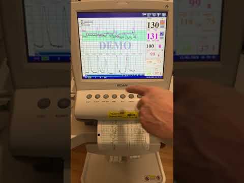 Buy Edan F9 Express Fetal Monitor with Twin FHR Monitoring | 12.1" TFT ...