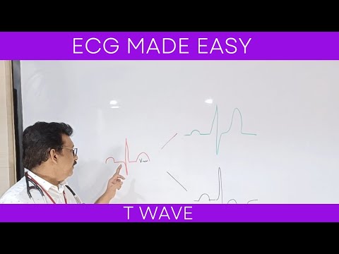 ECG Made Easy || T waves