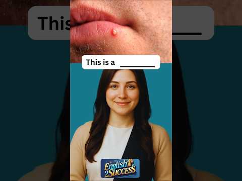 Do You Know These Words? Skin Problems Vocabulary