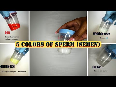 5 COLORS of sperm (semen)