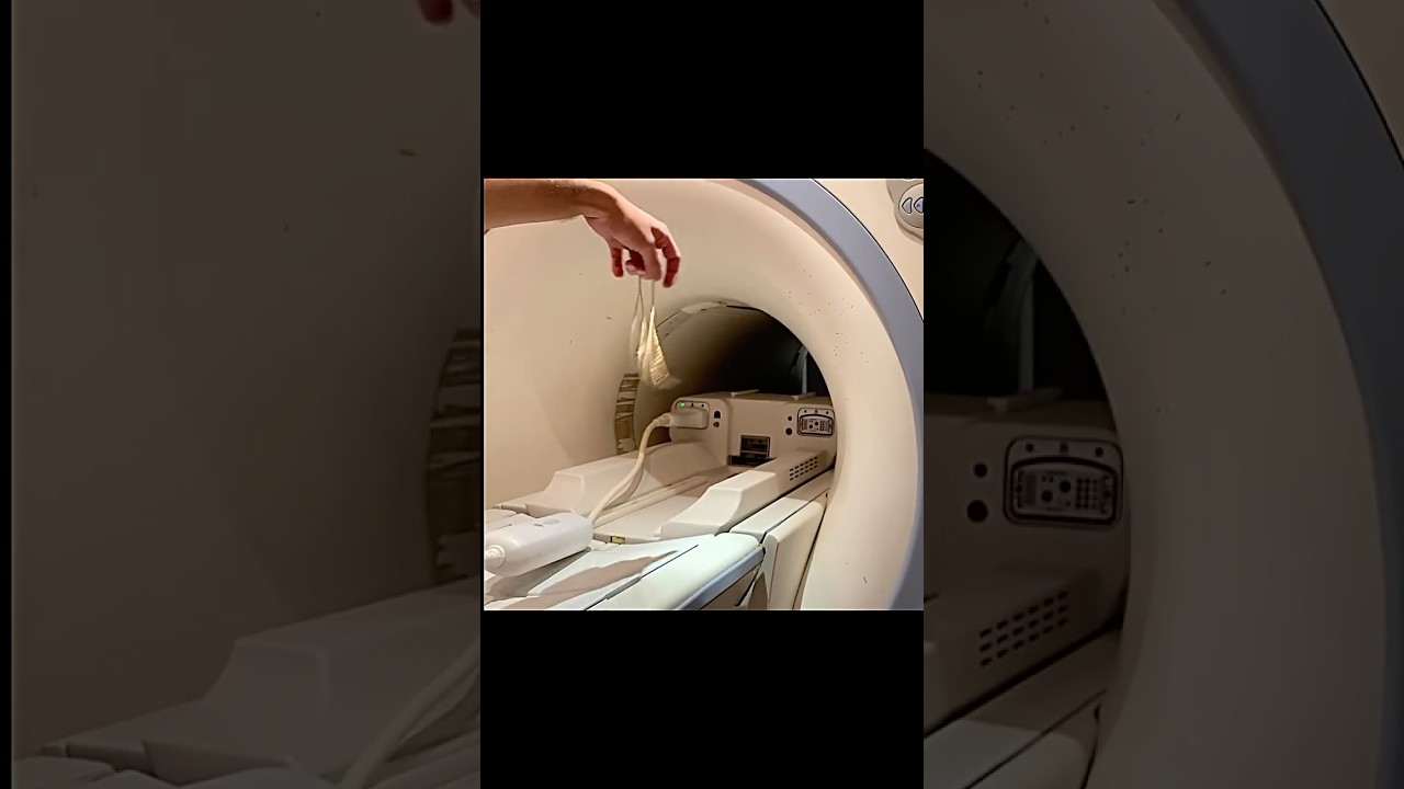 This Is Why Gold Jewelry Should Never Enter The MRI Scan Room #radiology #science #mriscan