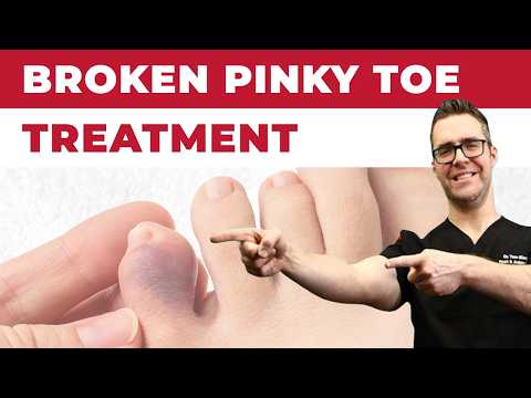 Sprained Pinky Toe | Michigan