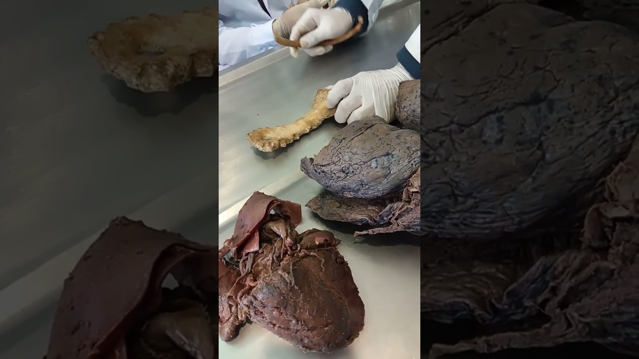 Clase práctica 3-anatomía - Sábado - Tórax (huesos, corazón, pulmón)