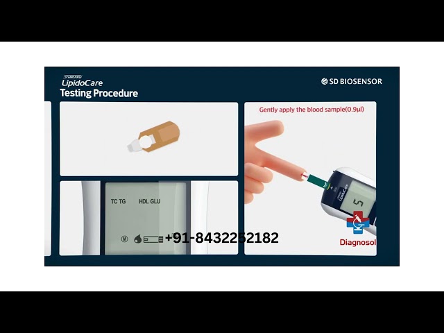 Lipid Profile Meter - SD Standard Lipidocare Analyzer For Lipid Profile ...