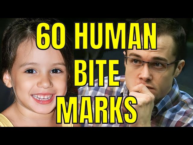 The Tragic Story of Tegan Skiba: A Case of Child Abuse and Neglect | Magica