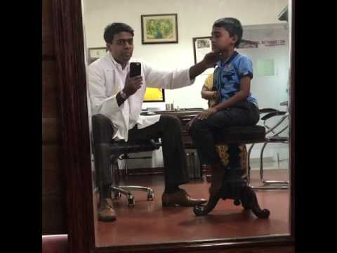 Cleft lip and palate long term results