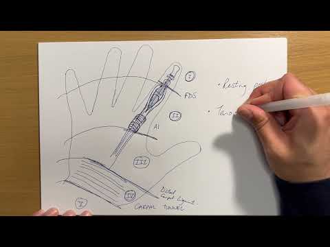 Hands for the FRCS (Tr & Orth) - Flexor Tendon Injury & Repair