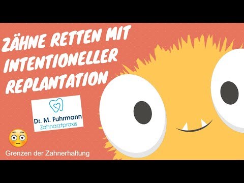 Intentionelle Replantation